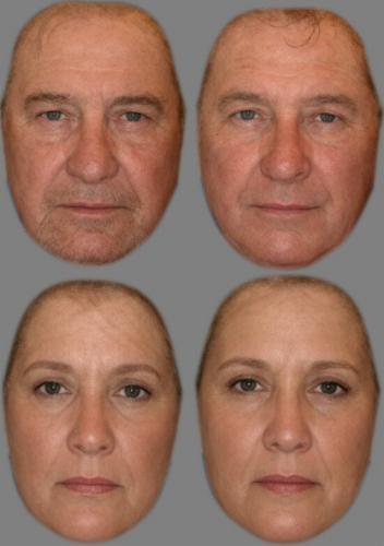 Smoking & Skin Aging – DermaHealth
