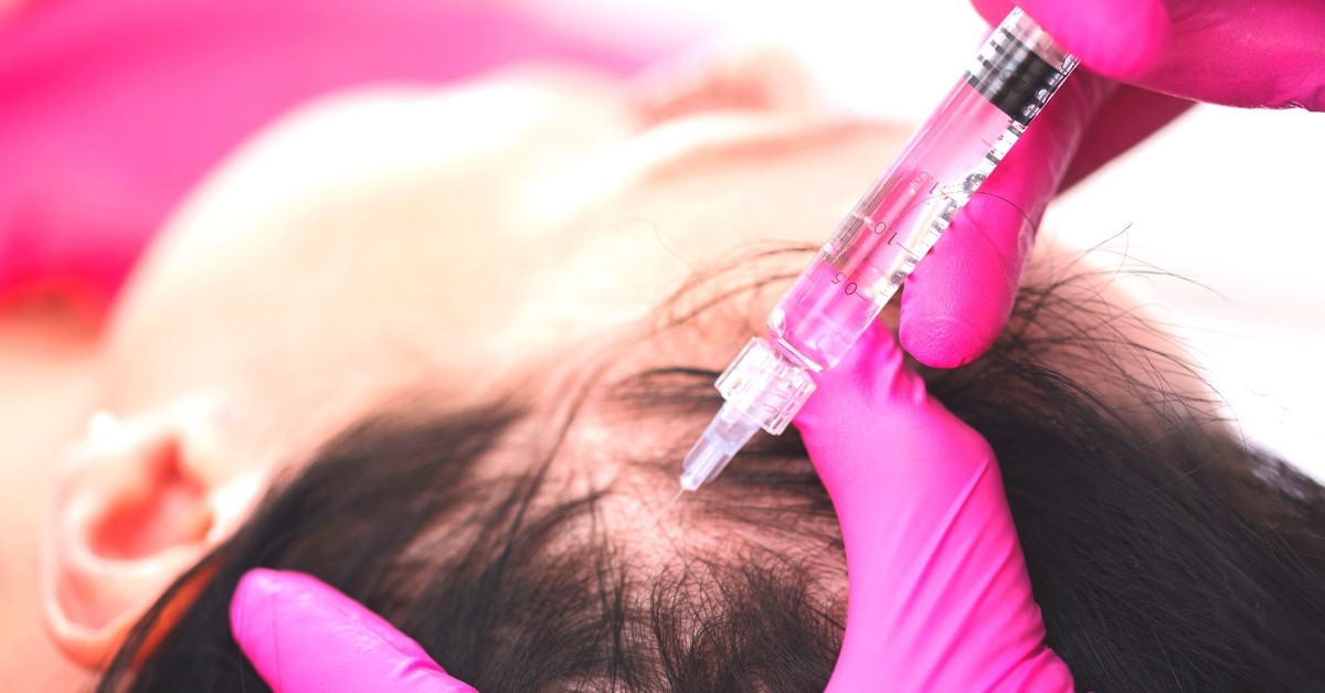 Plasma Injection – DermaHealth