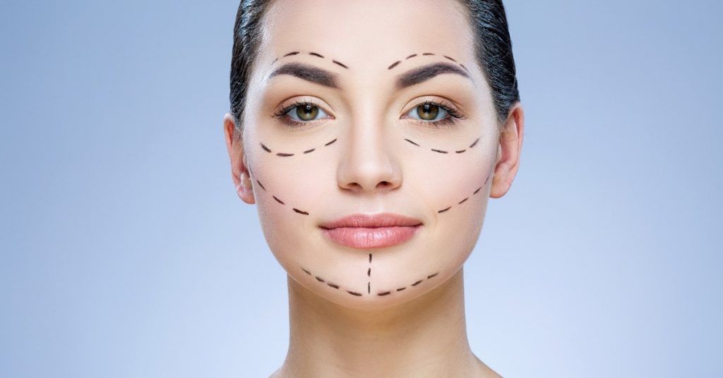 Geometric Technique for Botox Injection Sites and Which Areas to Avoid ...