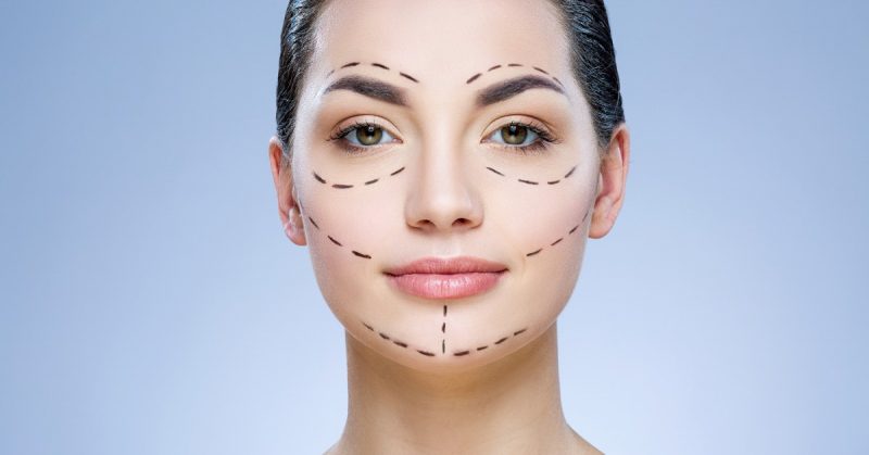 Geometric Technique for Botox Injection Sites and Which Areas to Avoid ...