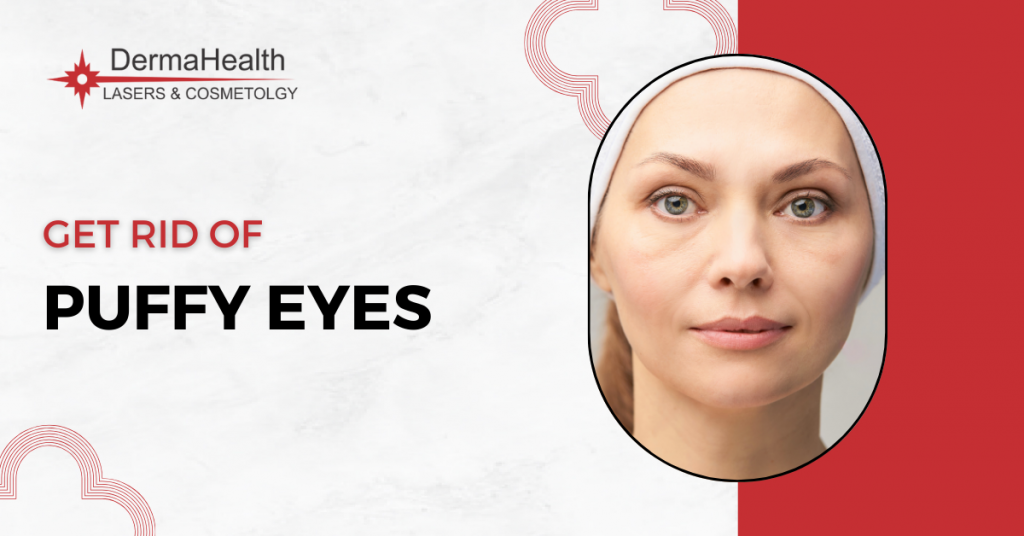 Puffy Eyes: Understanding the Causes and Solutions – DermaHealth